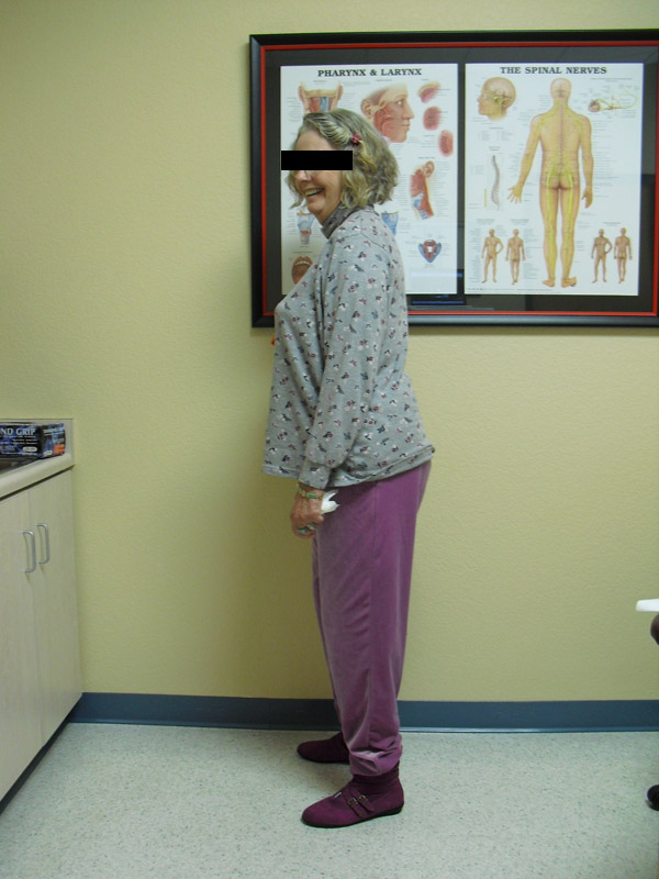 S2 Iliac Fixation – Center for Advanced Spine Care of Southern Arizona