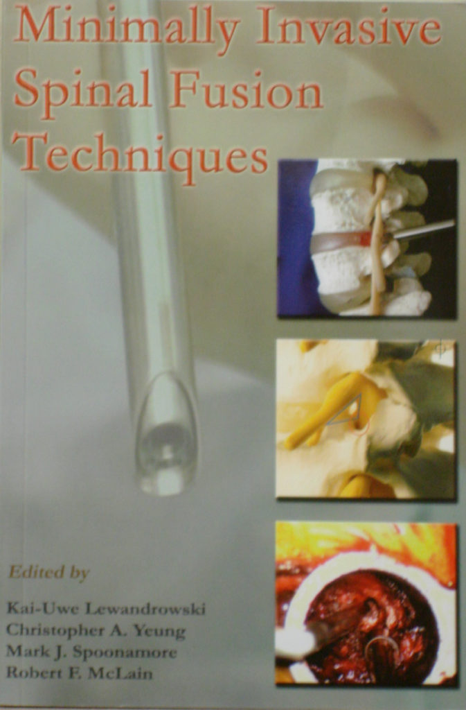 Books Edited - Center for Advanced Spine Care of Southern Arizona